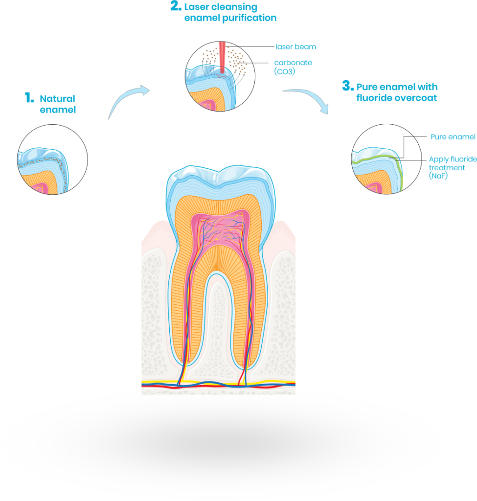 Enamel Pure – Healthy Enamel Pure Smiles